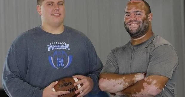 Inspiring Athletes with Vitiligo – NaturWarriors